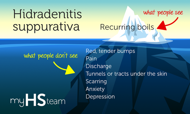 Hidradenitis Suppurativa (HS): What People Don't See (Infographic ...