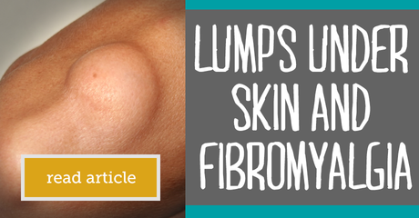 Fibromyalgia Support Online | Fibromyalgia Social Network - MyFibroTeam